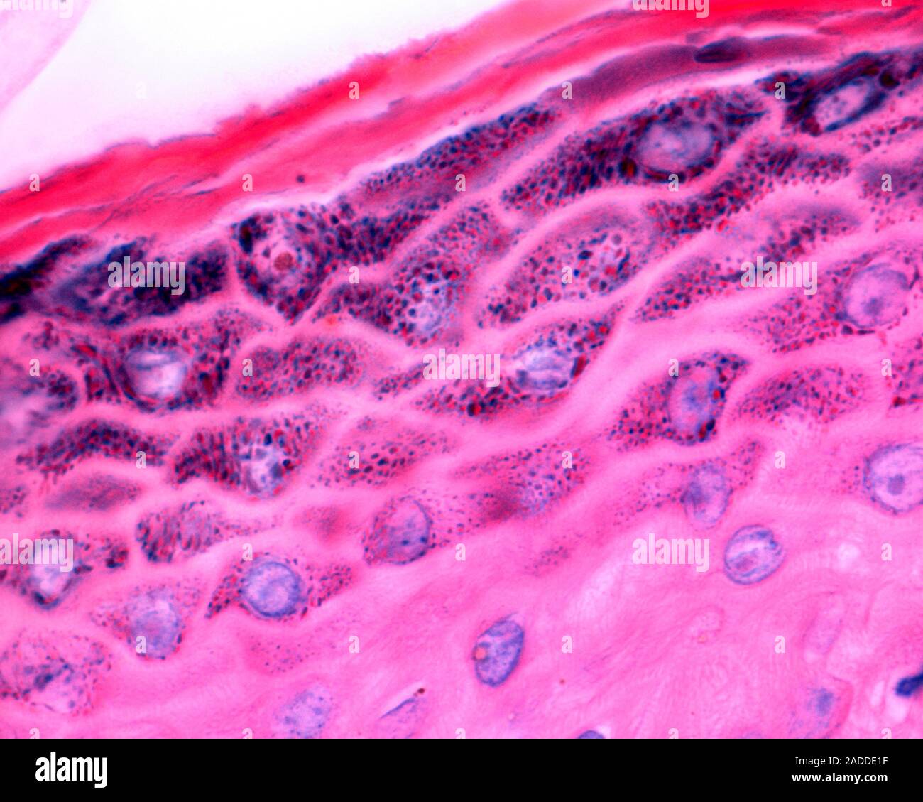 Light micrograph of a section through the epidermis of the skin. Seen ...
