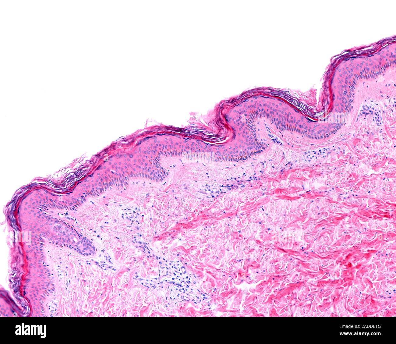 Skin, light micrograph. The epidermis is the outer layer of skin. The ...