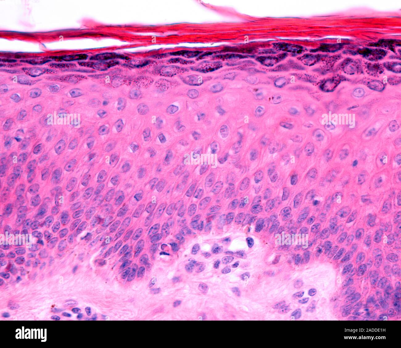 Skin epidermis, light micrograph. The epidermis is the outer layer of ...