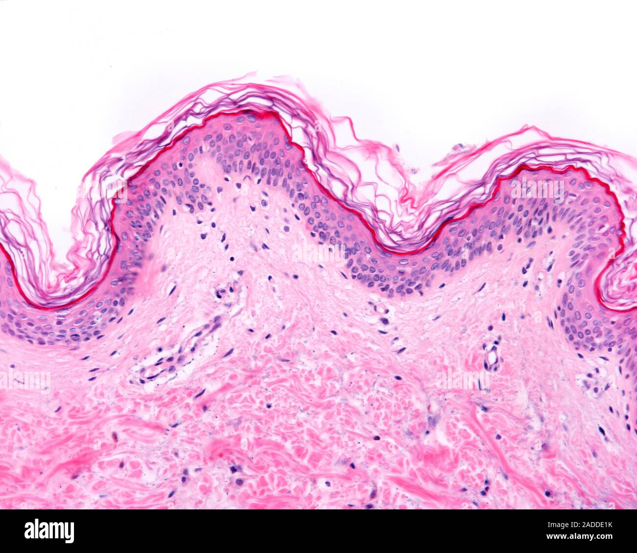Skin, light micrograph. The epidermis is the outer layer of skin. The ...