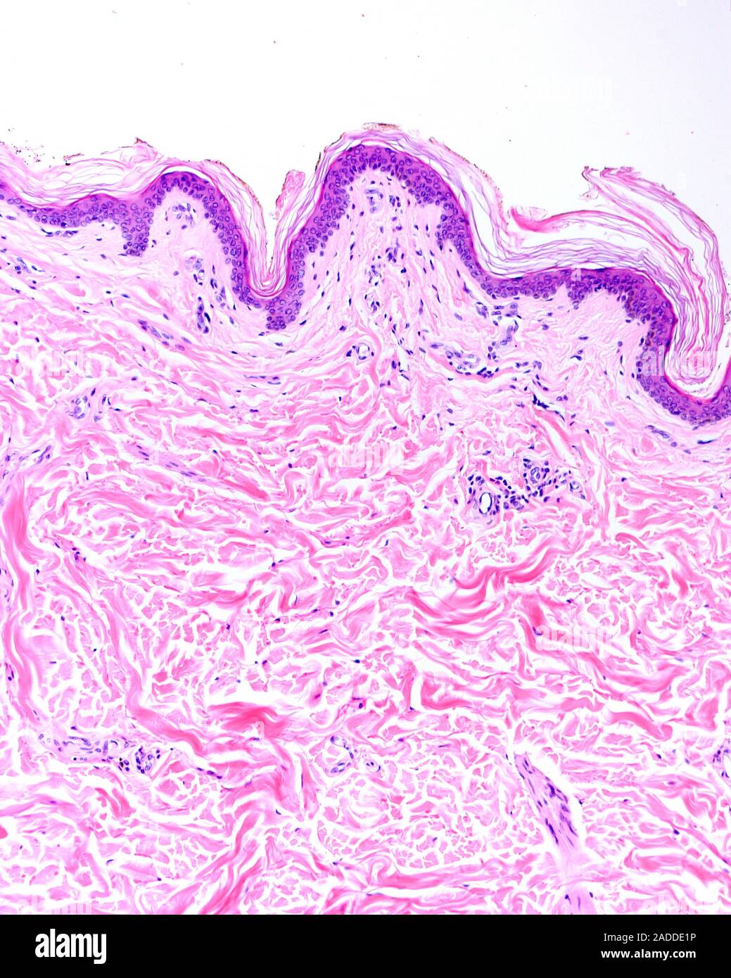 Skin, light micrograph. The epidermis is the outer layer of skin ...