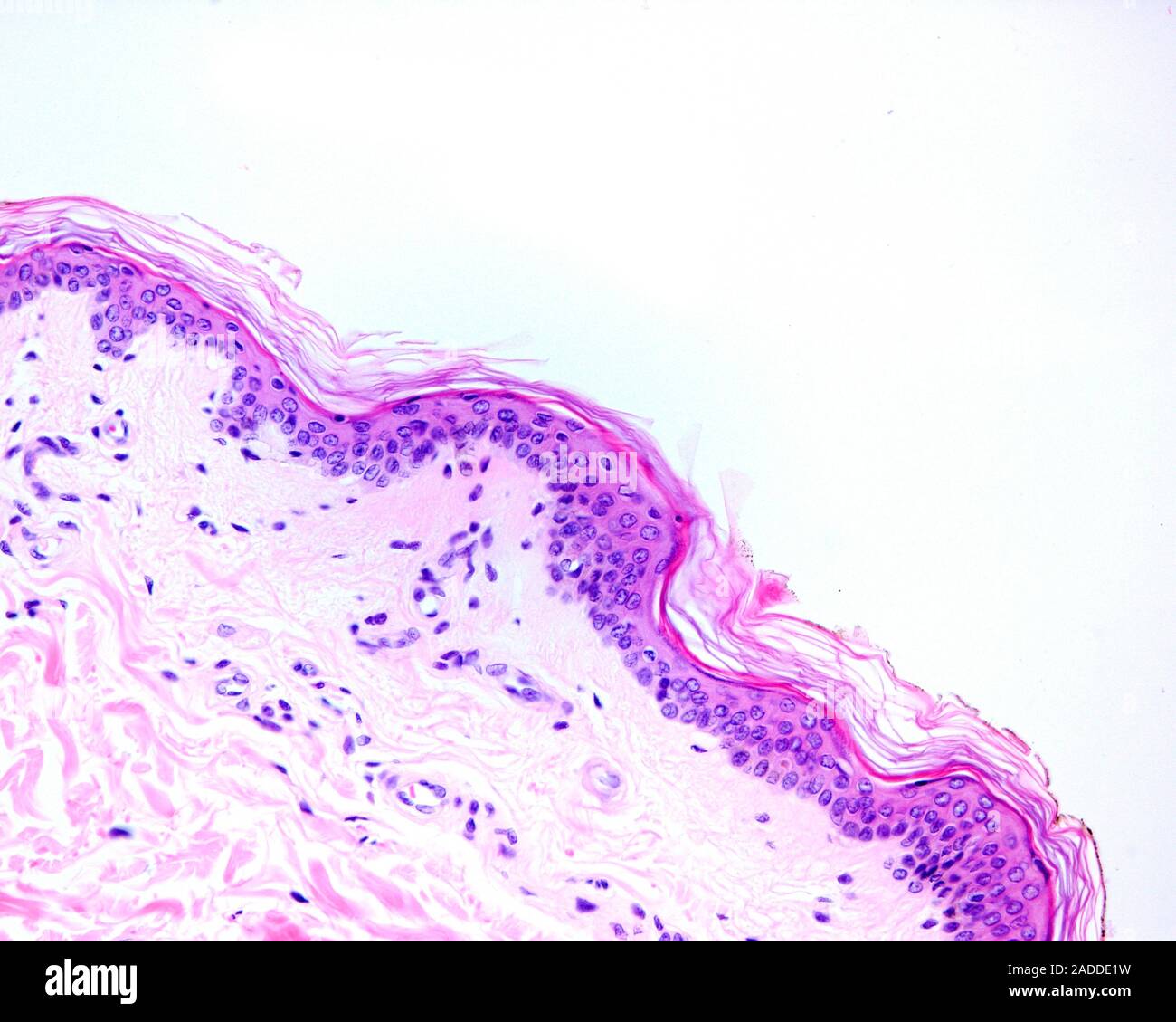 Skin, light micrograph. The epidermis is the outer layer of skin. The ...