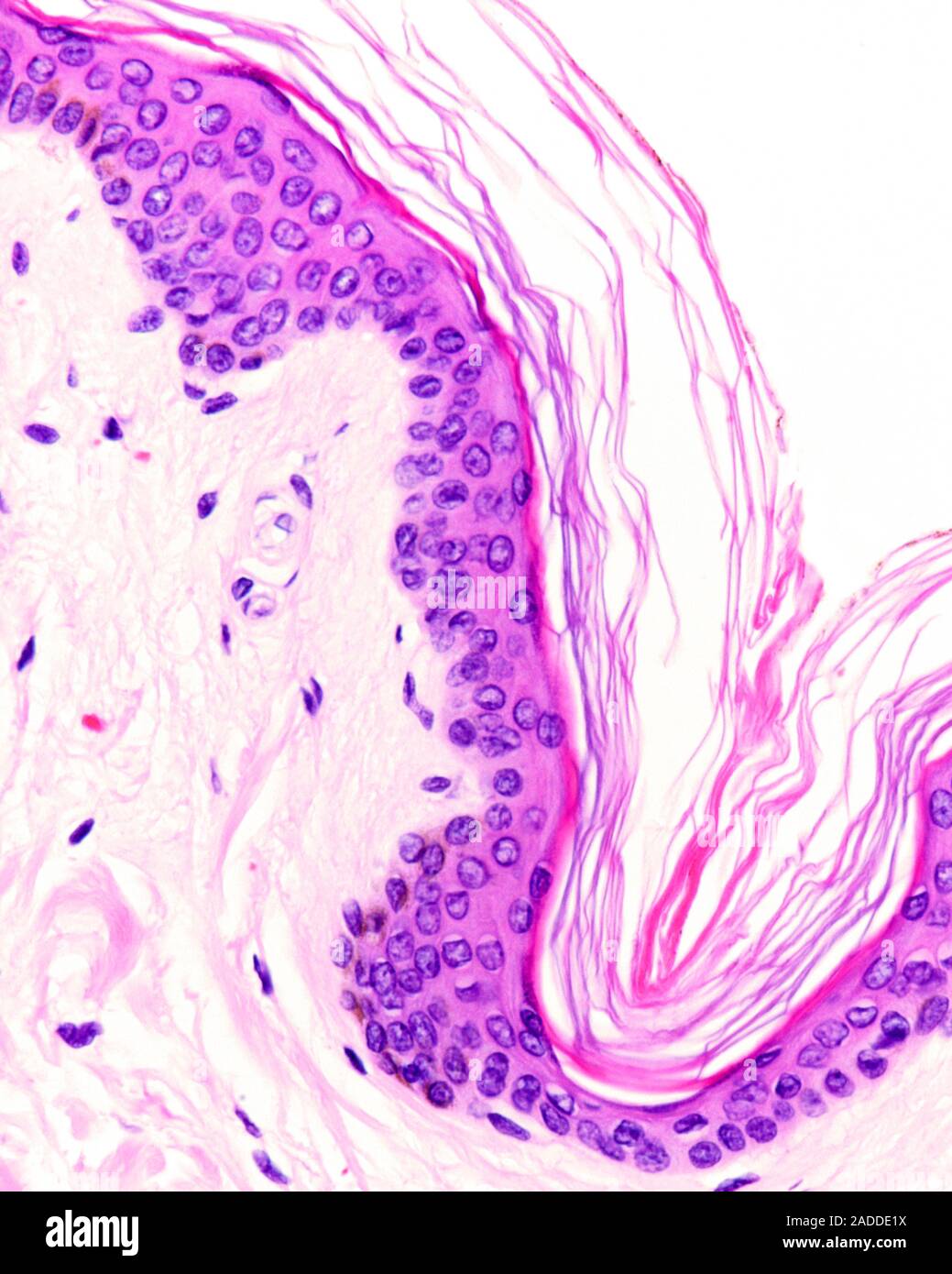 Stratum Corneum