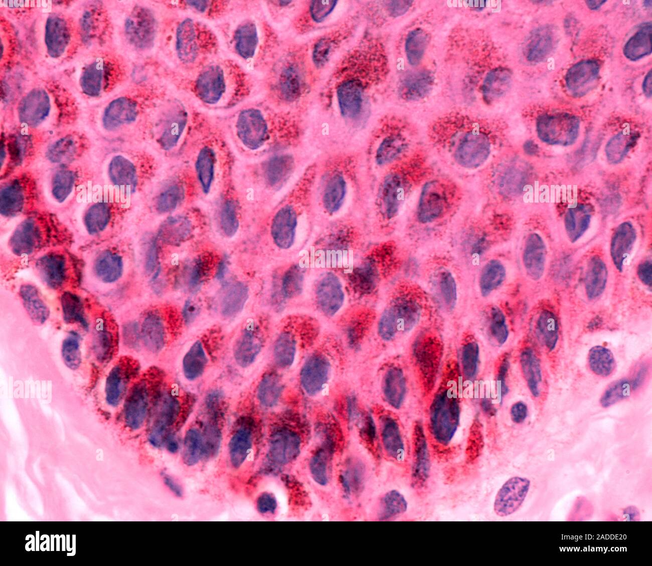 Light micrograph of a section through the epidermis of the skin stained ...