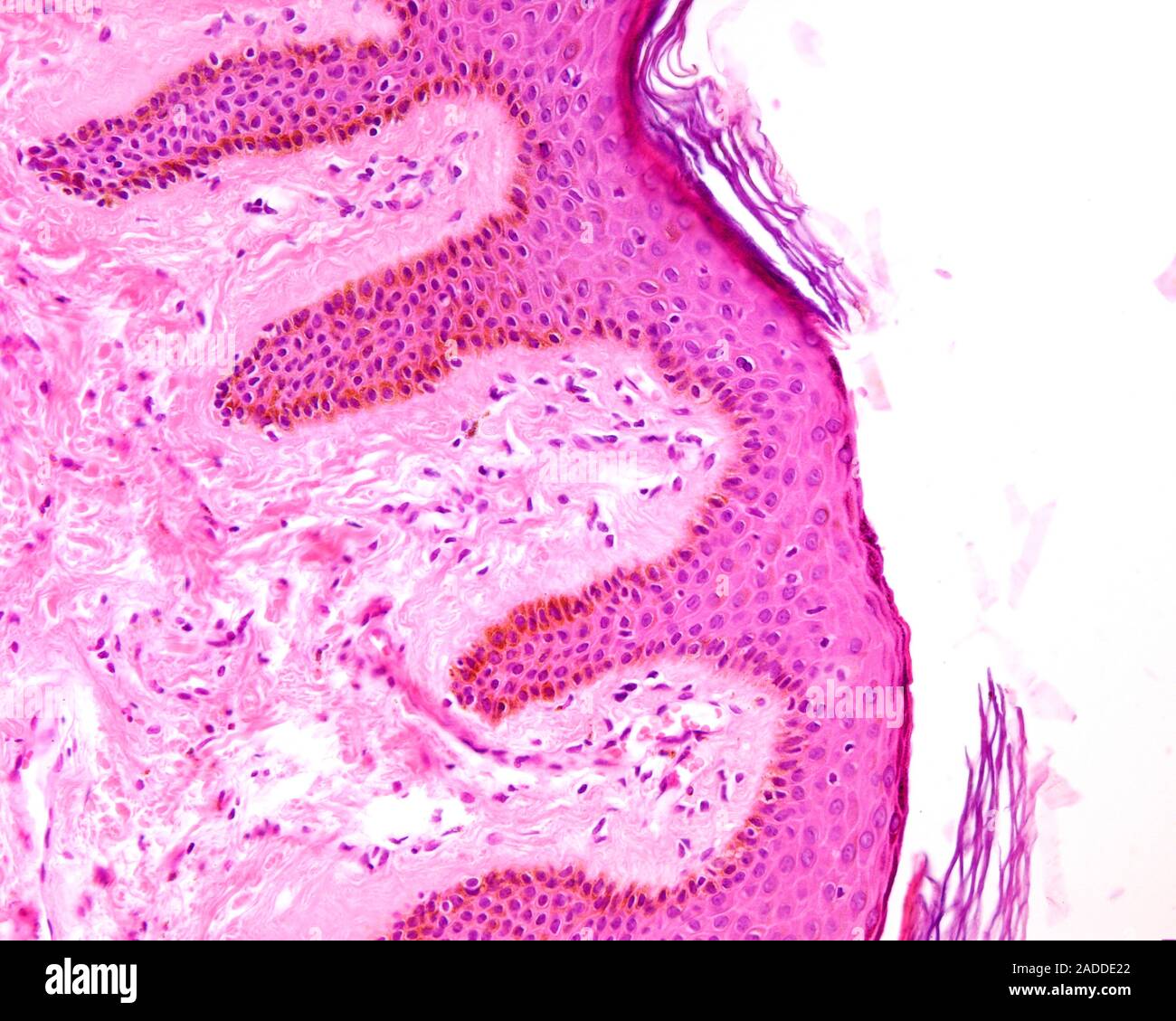 Light micrograph of a section through the skin stained with ...
