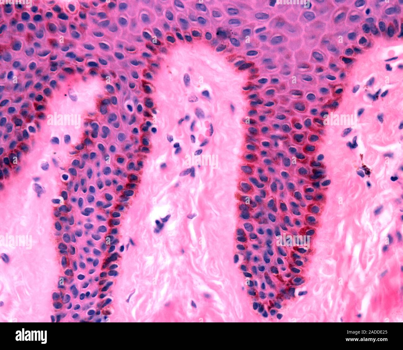 Light micrograph of a section through the deep region of the epidermis ...