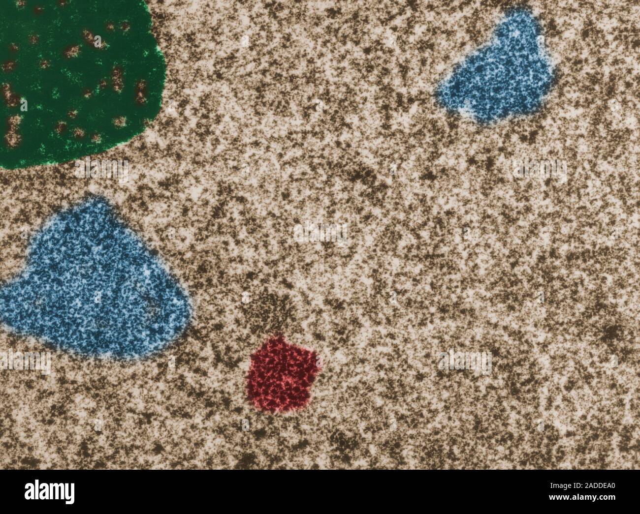 Coloured transmission electron micrograph (TEM) of a neuron nucleus, showing the nucleolus (dark ...