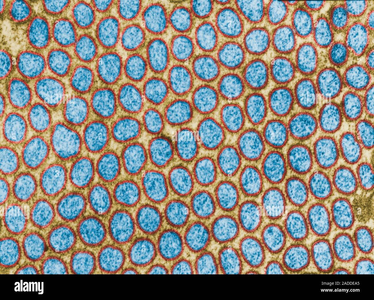Coloured transmission electron micrograph (TEM) showing a brush (or striated) border in cross ...