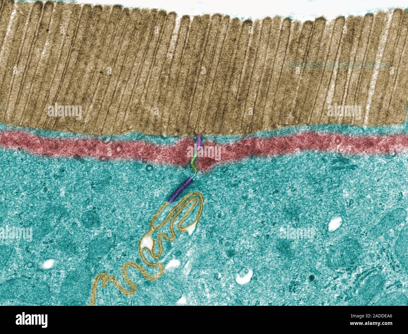 Coloured transmission electron micrograph (TEM) of two cells from the ...