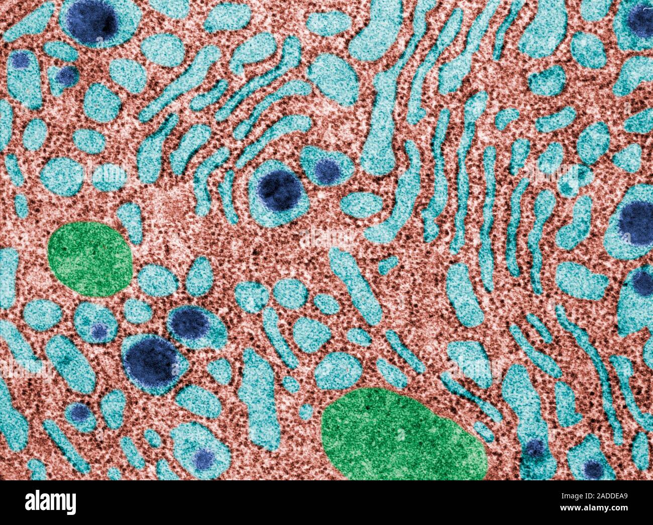 Rough Endoplasmic Reticulum Electron Micrograph