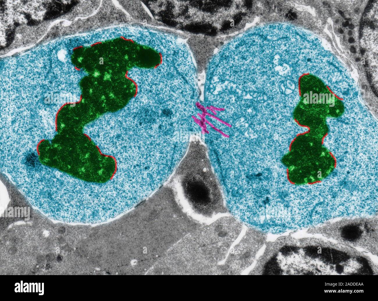 Coloured transmission electron micrograph (TEM) of a cell in the ...