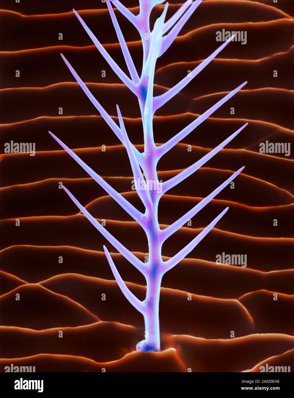 Coloured scanning electron micrograph (SEM) of Exoskeleton branched ...
