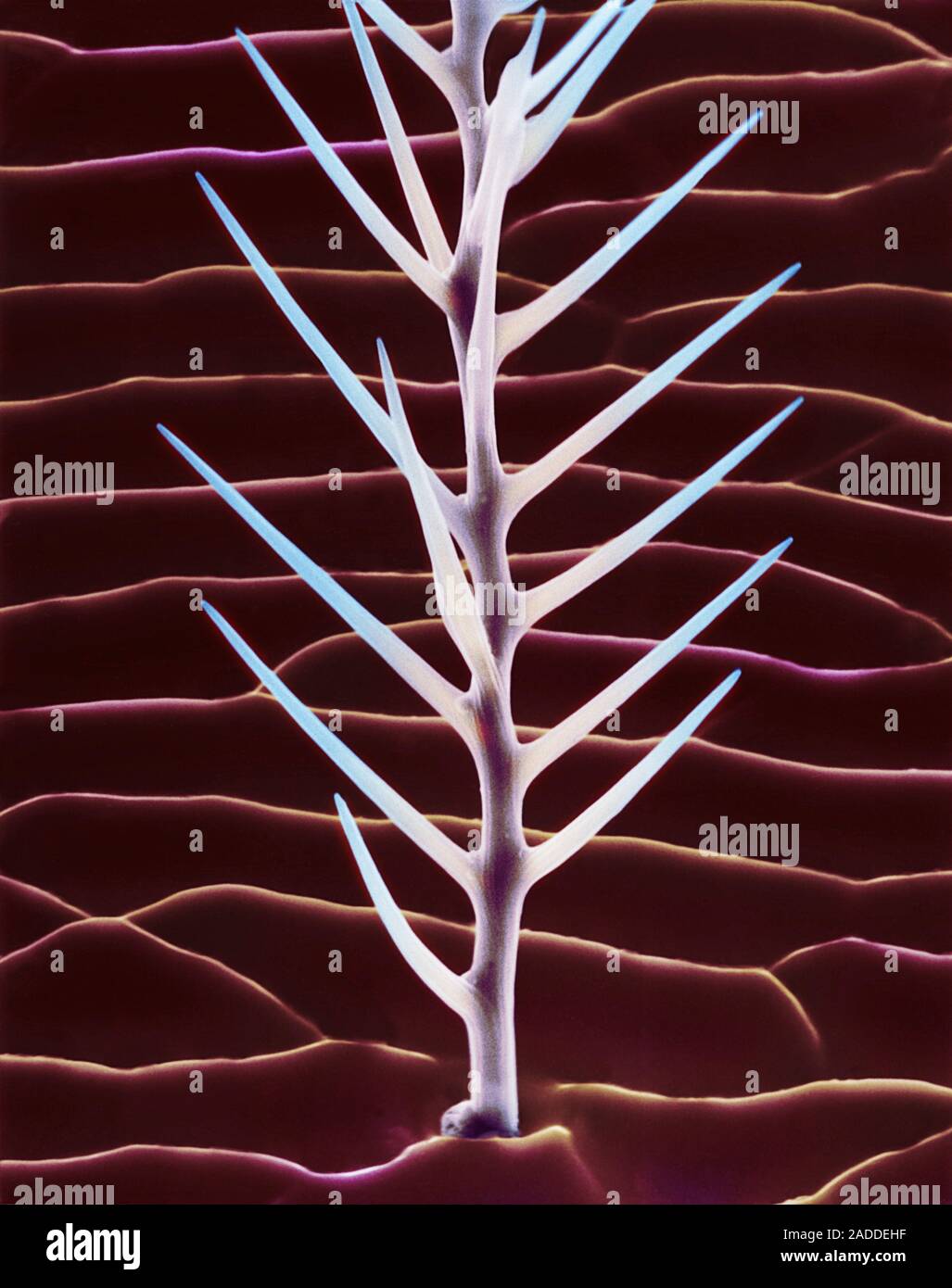 Coloured scanning electron micrograph (SEM) of Exoskeleton branched ...