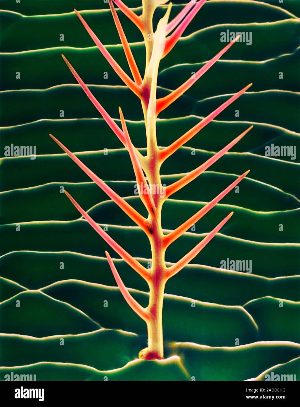 Coloured scanning electron micrograph (SEM) of Exoskeleton branched ...