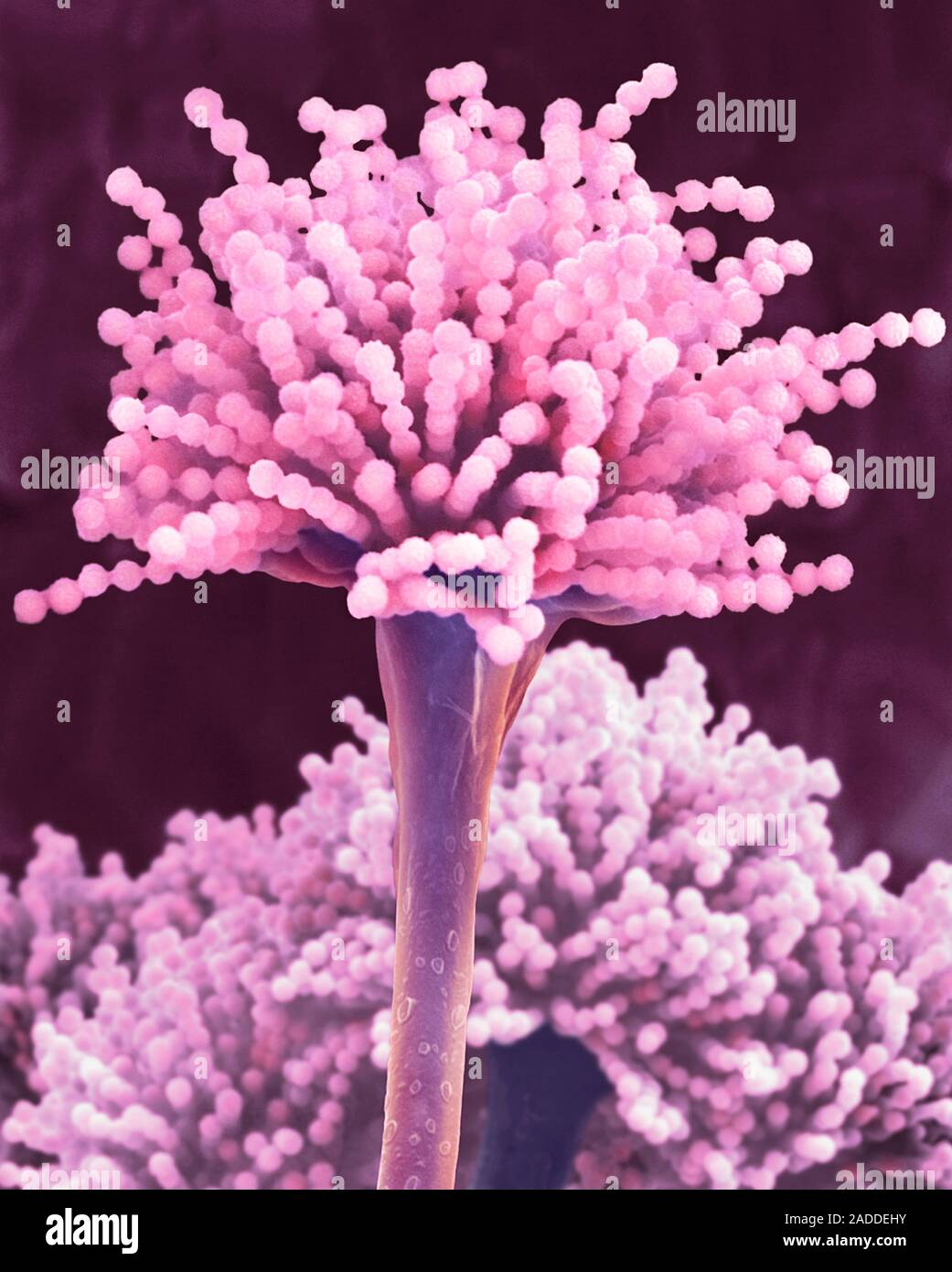 Coloured scanning electron micrograph (SEM) of Mould (Aspergillus ...