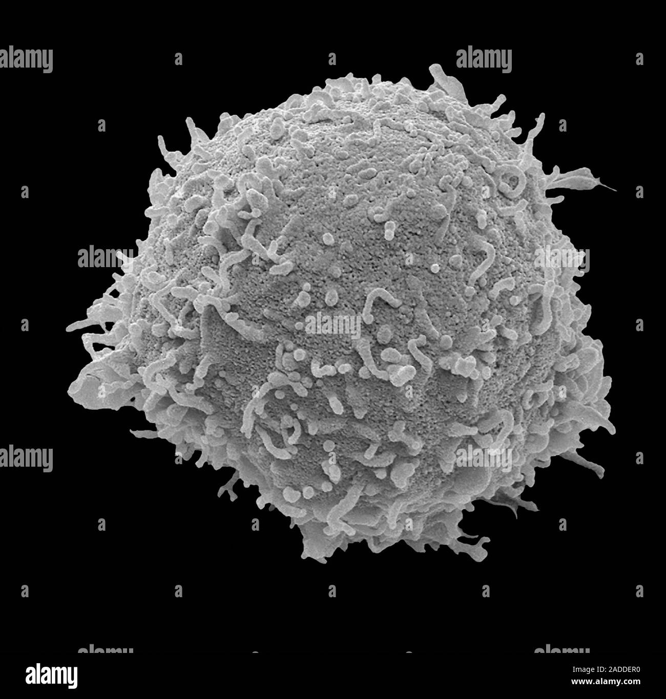 T Lymphocyte, scanning electron micrograph (SEM). T lymphocytes, or T ...