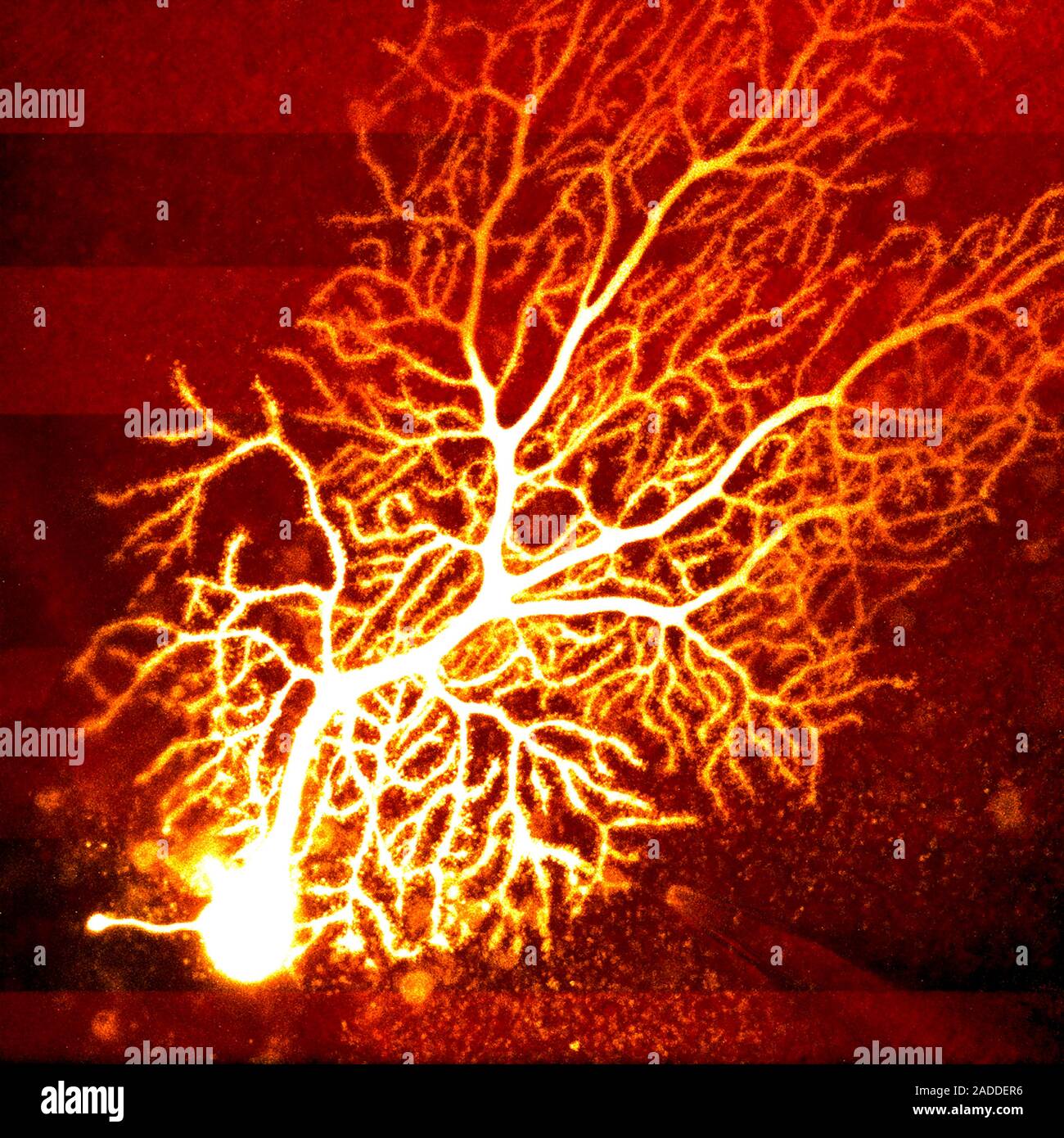 Coloured confocal light micrograph of a Purkinje neuron (nerve cell ...