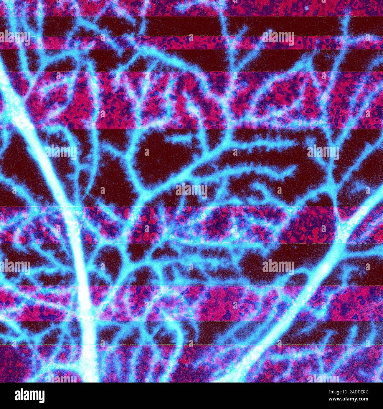 Coloured confocal light micrograph of dendrites from a Purkinje neuron ...