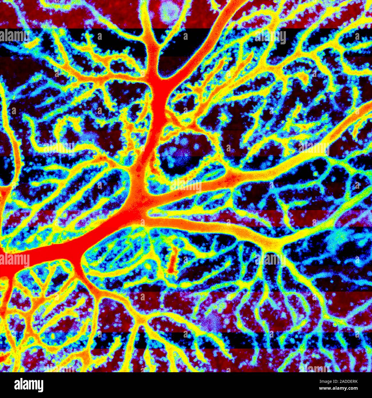 Coloured confocal light micrograph of dendrites from a Purkinje neuron ...