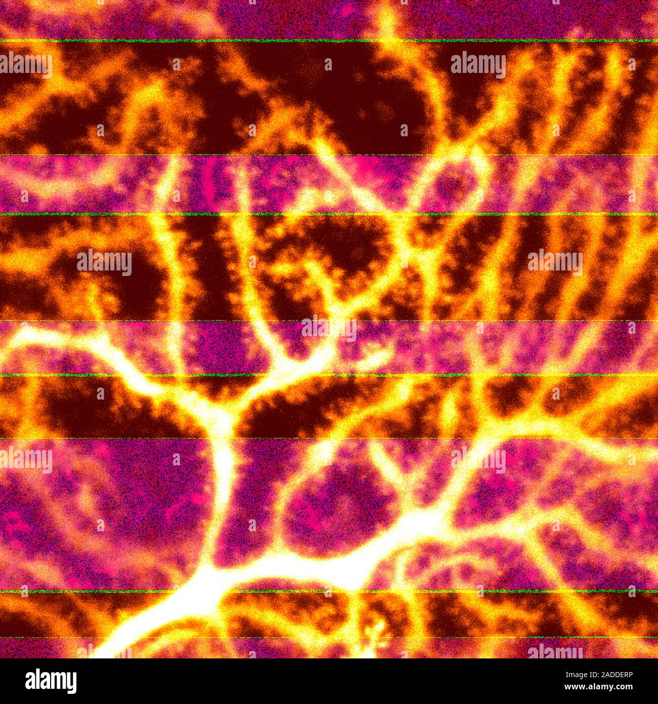 Coloured confocal light micrograph of dendrites from a Purkinje neuron ...