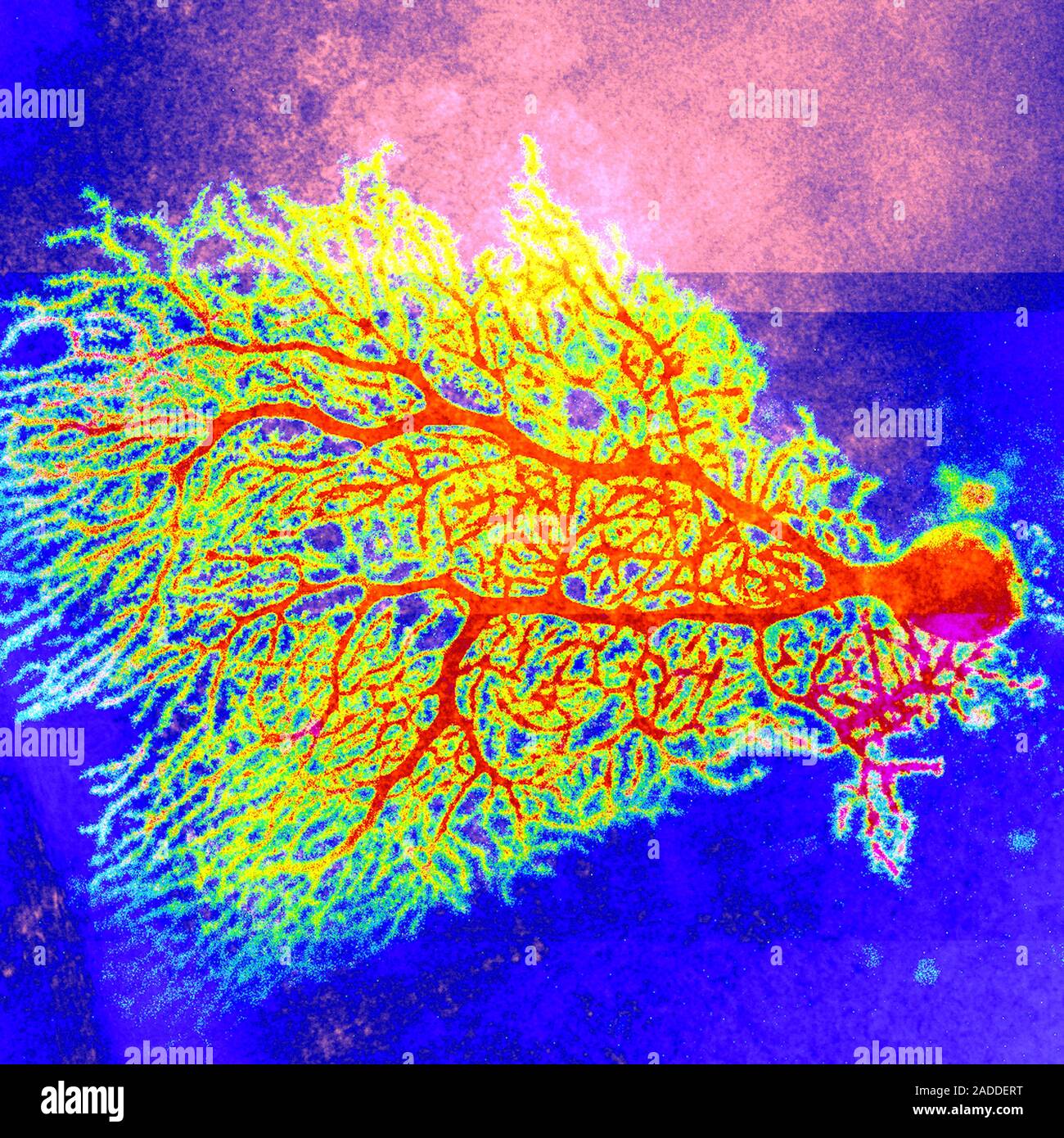 Coloured confocal light micrograph of a Purkinje neuron (nerve cell ...