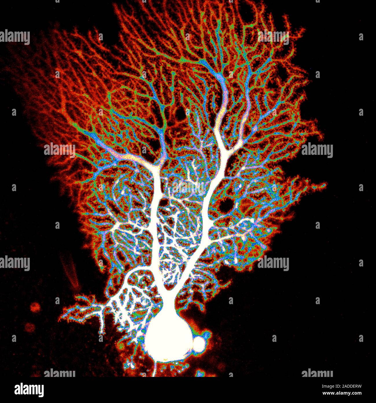 Coloured confocal light micrograph of a Purkinje neuron (nerve cell ...