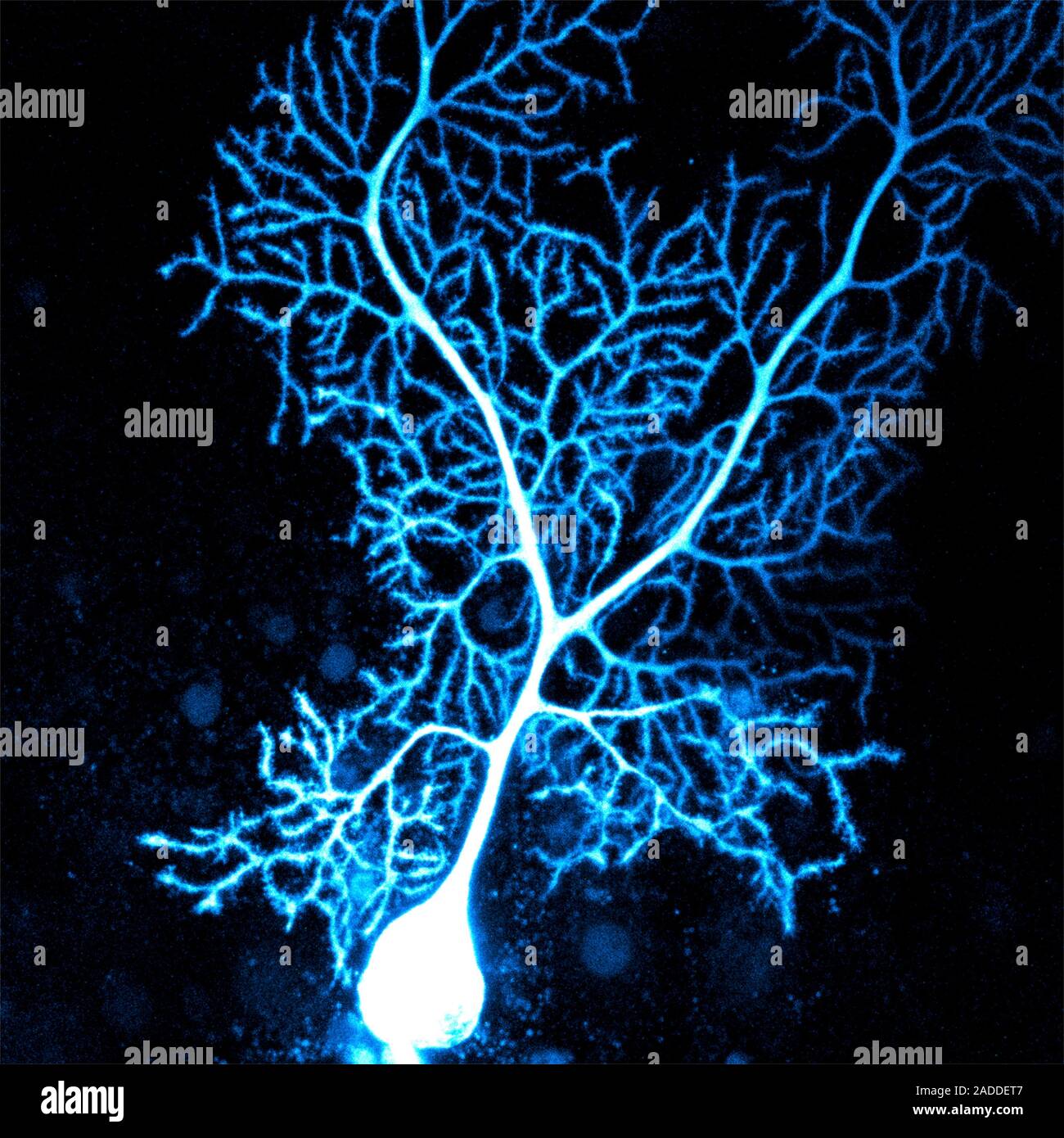 Coloured confocal light micrograph of a Purkinje neuron (nerve cell ...