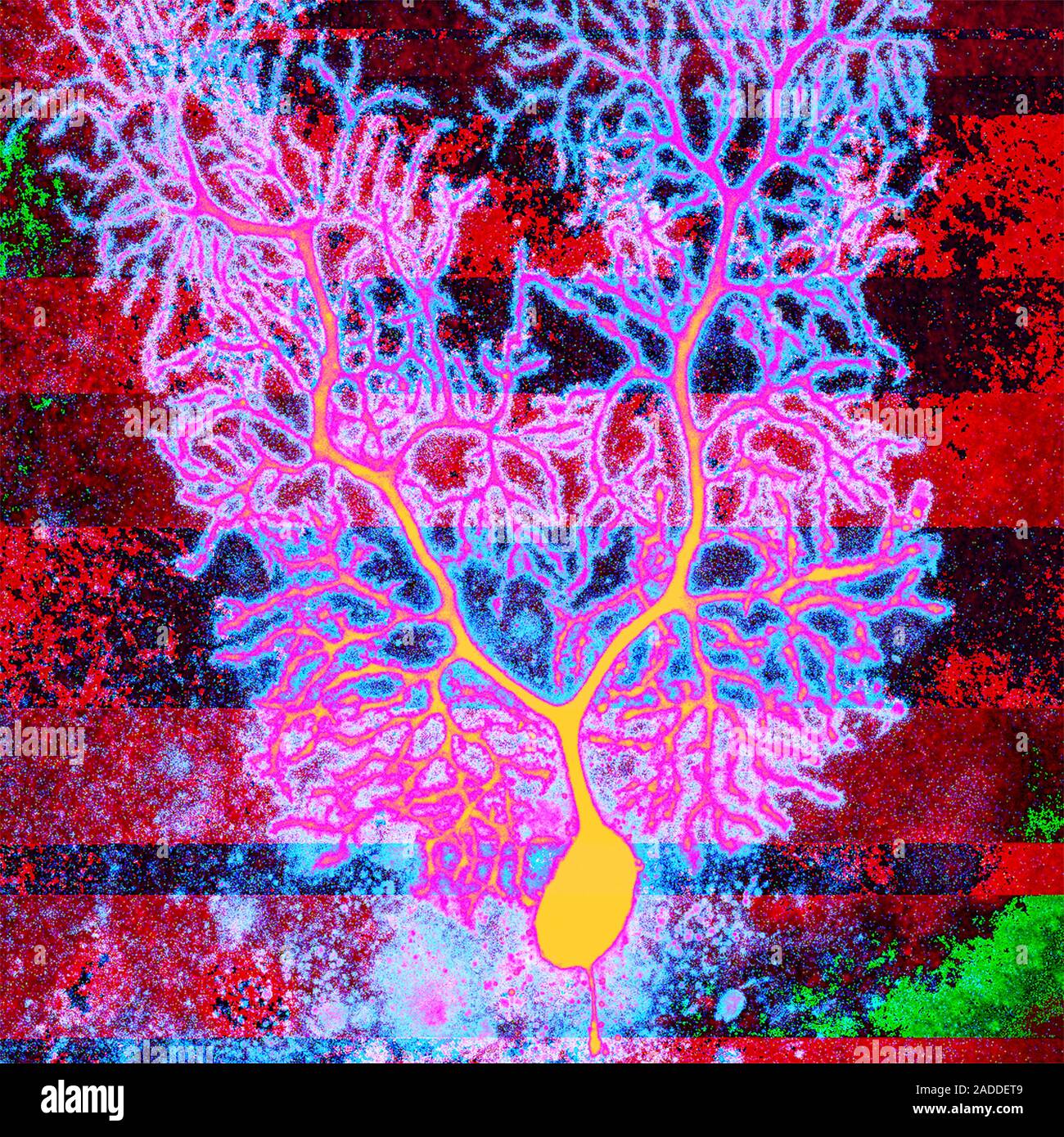 Coloured confocal light micrograph of a Purkinje neuron (nerve cell ...