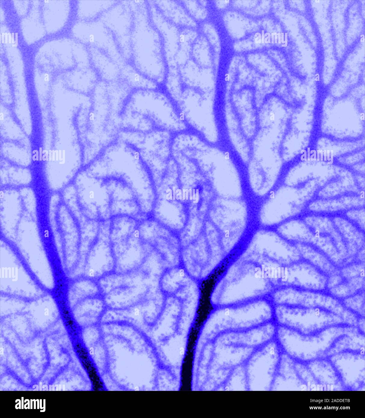 Coloured confocal light micrograph of dendrites from a Purkinje neuron ...
