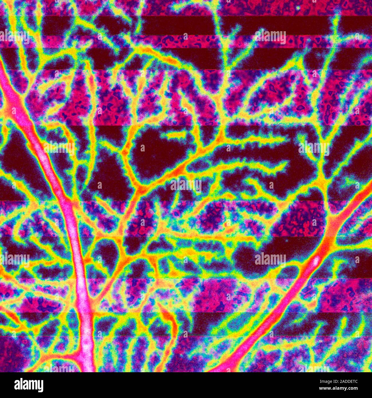 Coloured confocal light micrograph of dendrites from a Purkinje neuron ...