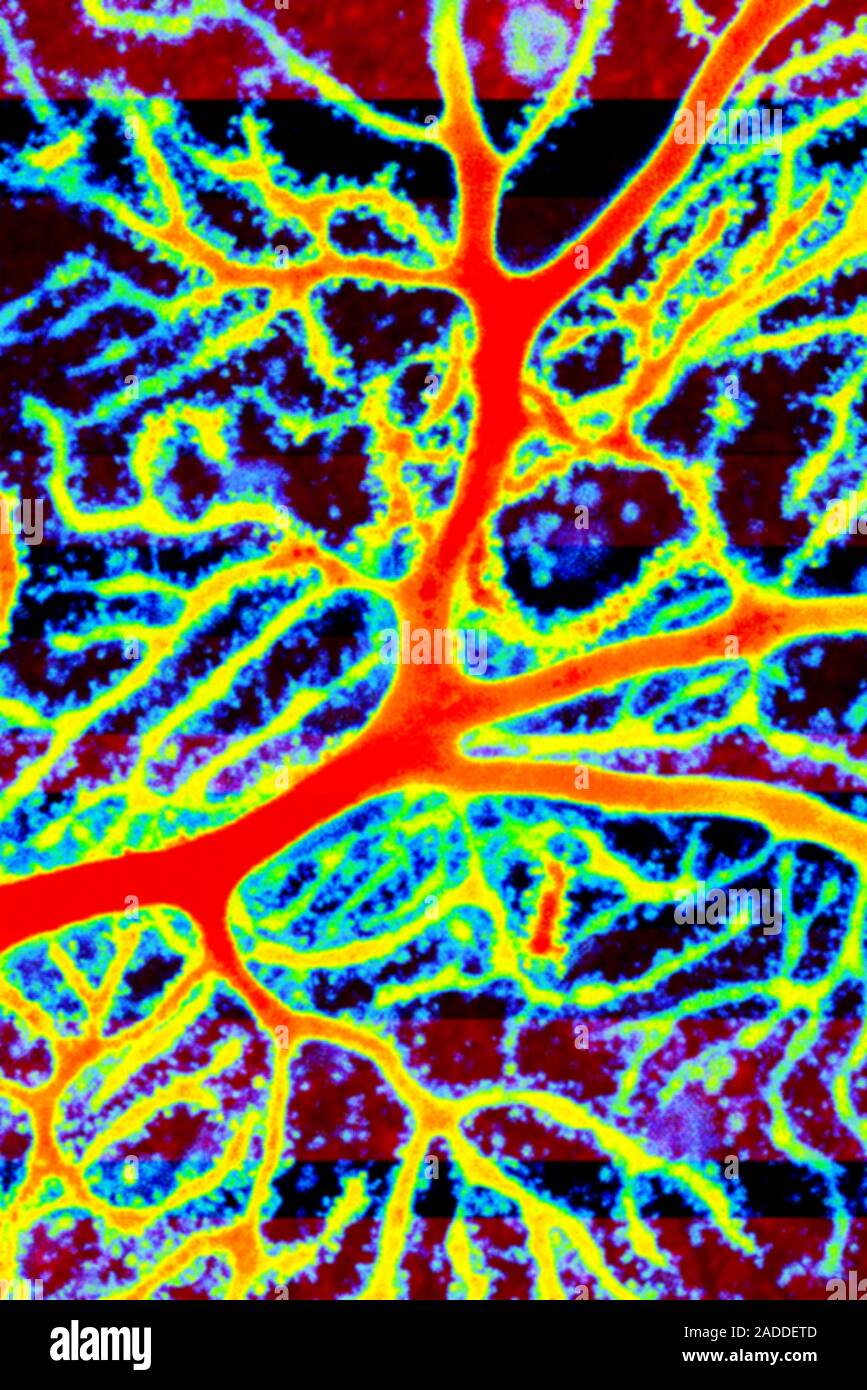 Coloured confocal light micrograph of dendrites from a Purkinje neuron ...