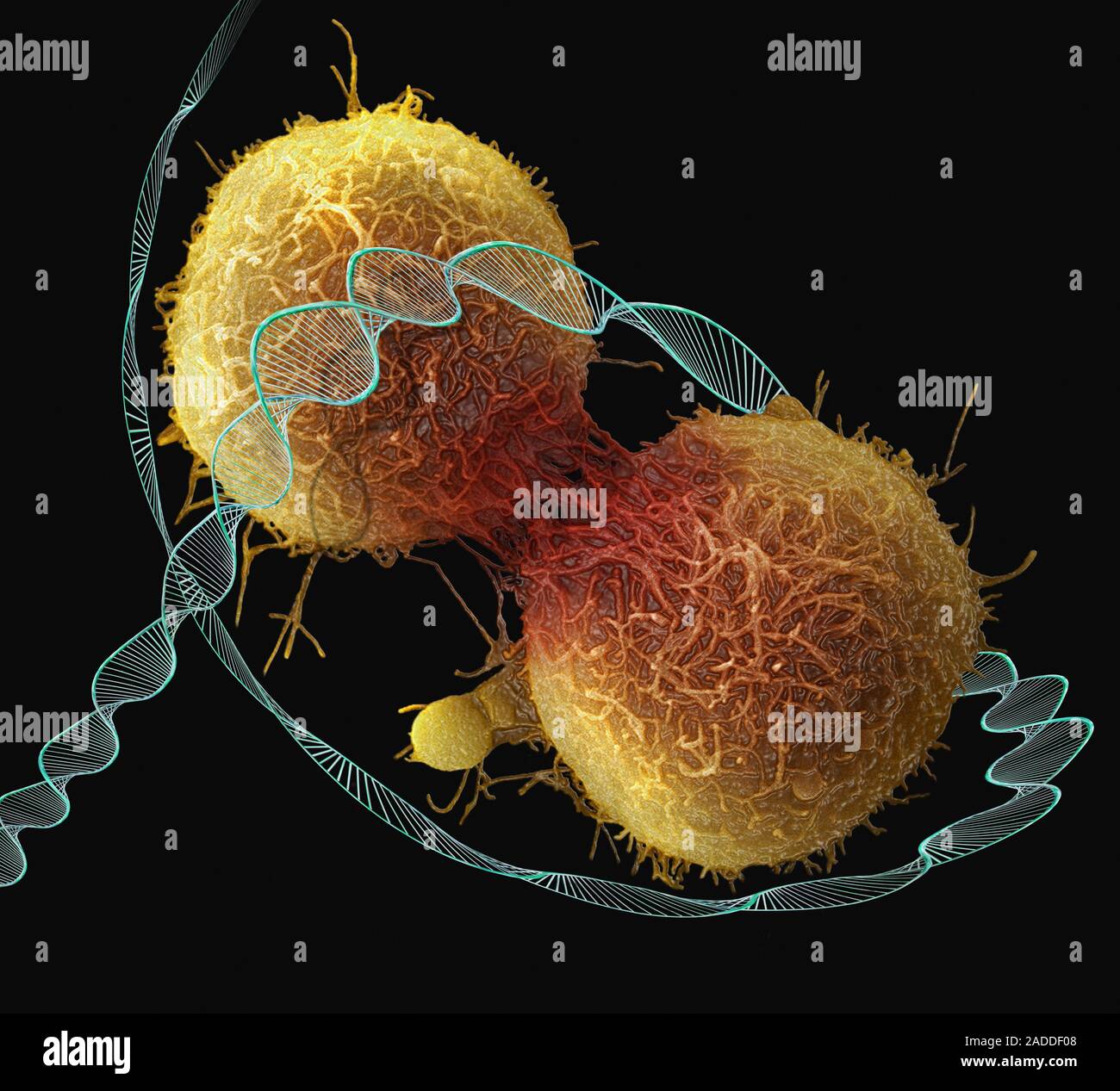 Cancer and DNA, conceptual composite image. Scanning electron ...