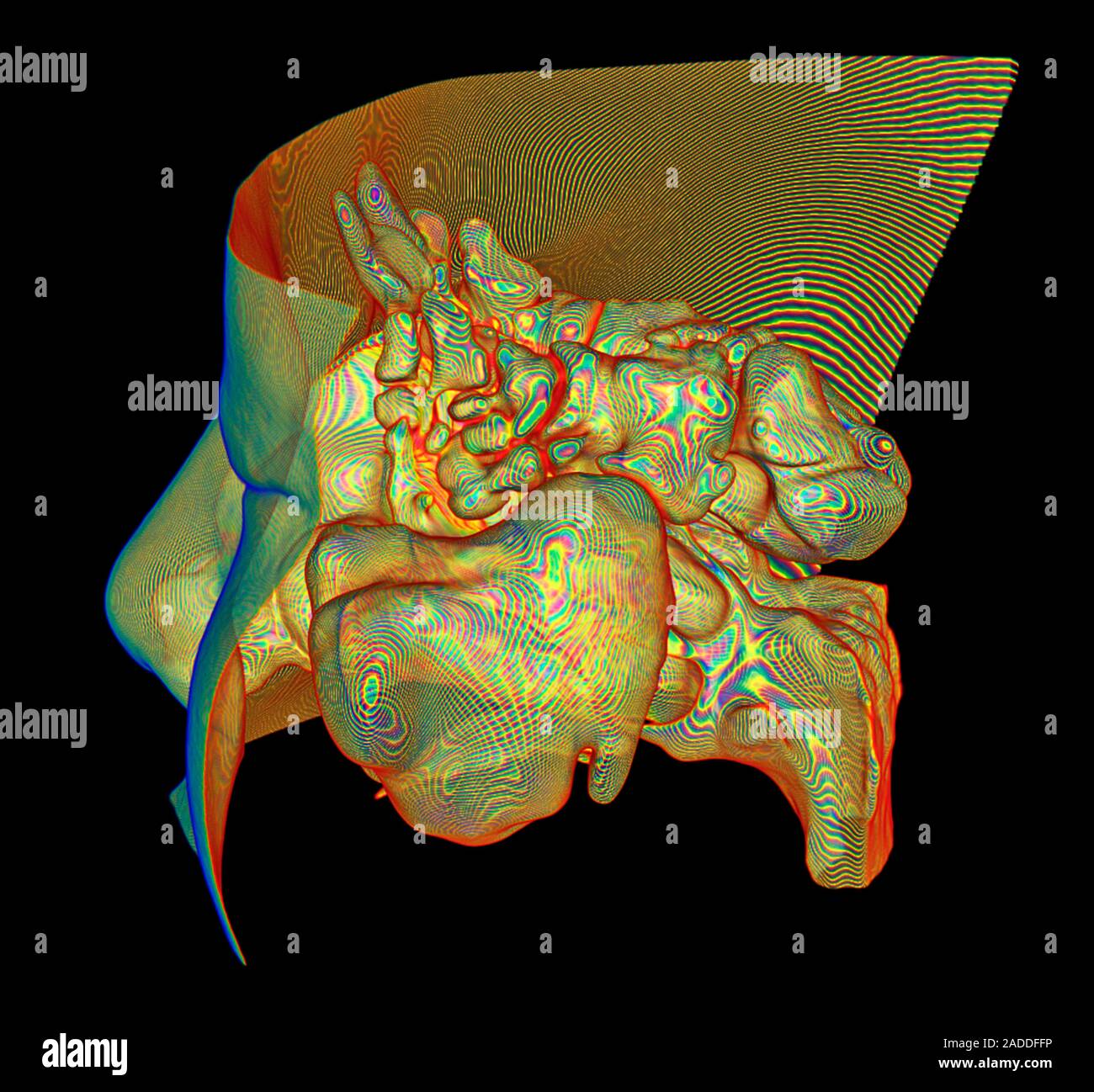 Paranasal sinuses and nose. Coloured 3D computed tomography (CT) scan ...