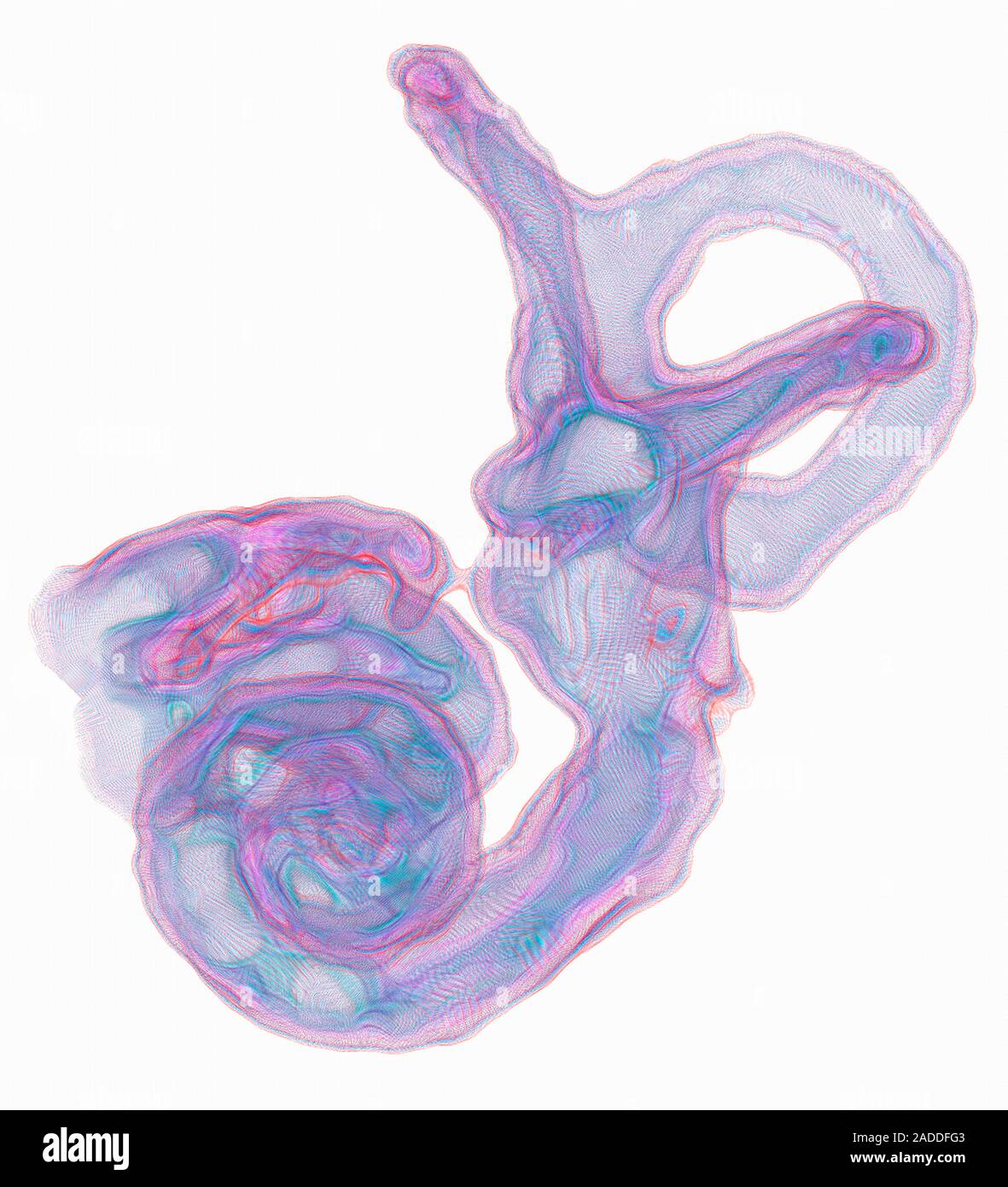 Inner ear structures. Coloured 3D magnetic resonance imaging (MRI) scan ...