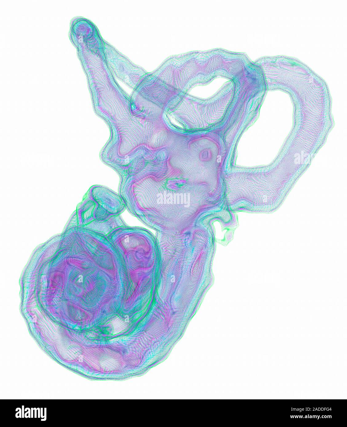 Inner ear structures. Coloured 3D magnetic resonance imaging (MRI) scan ...