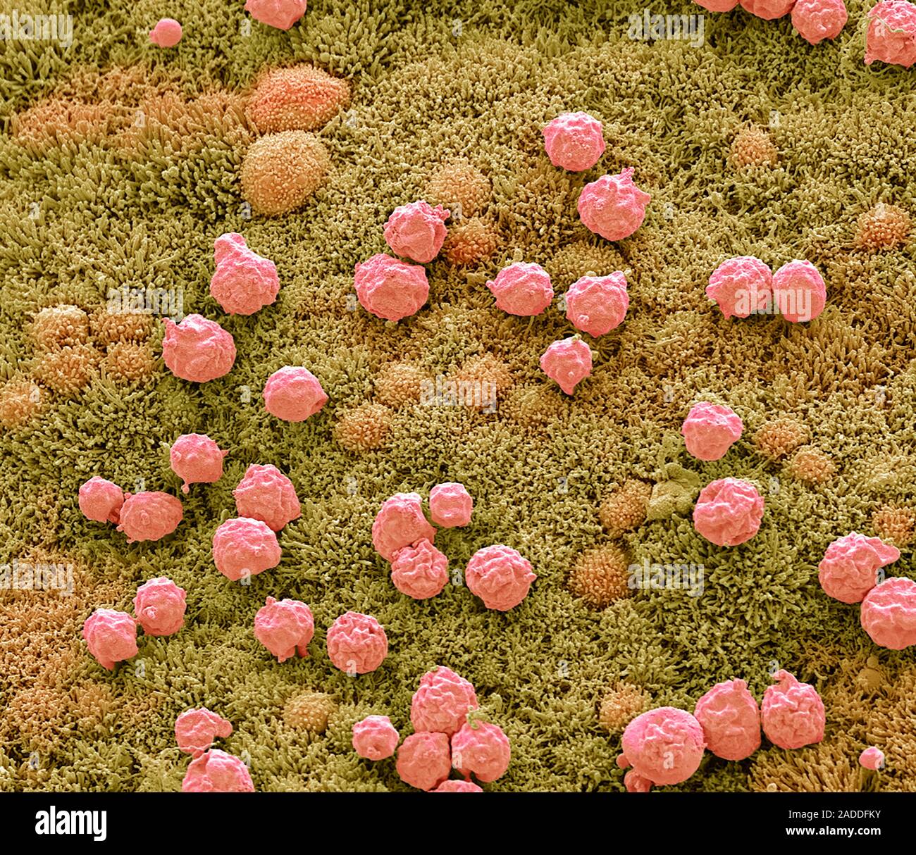 Nasal epithelium. Coloured scanning electron micrograph (SEM). Shown ...