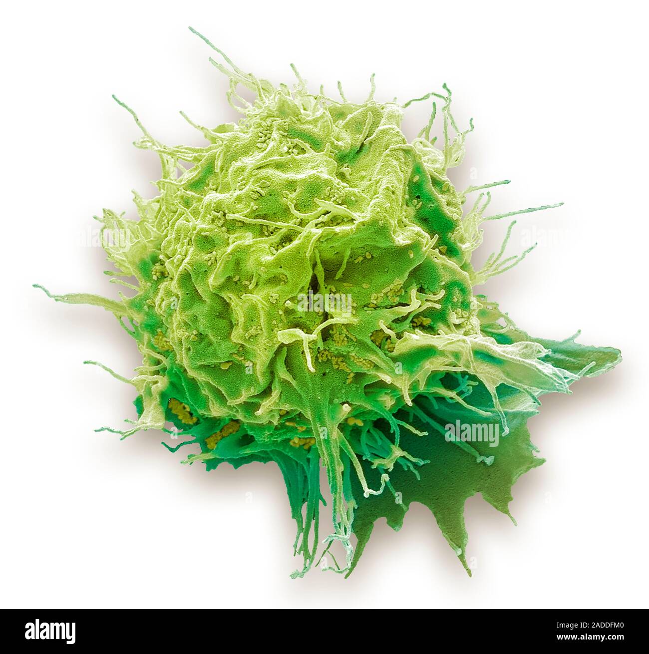 Herpes virus infected 293T cell, coloured scanning electron micrograph ...