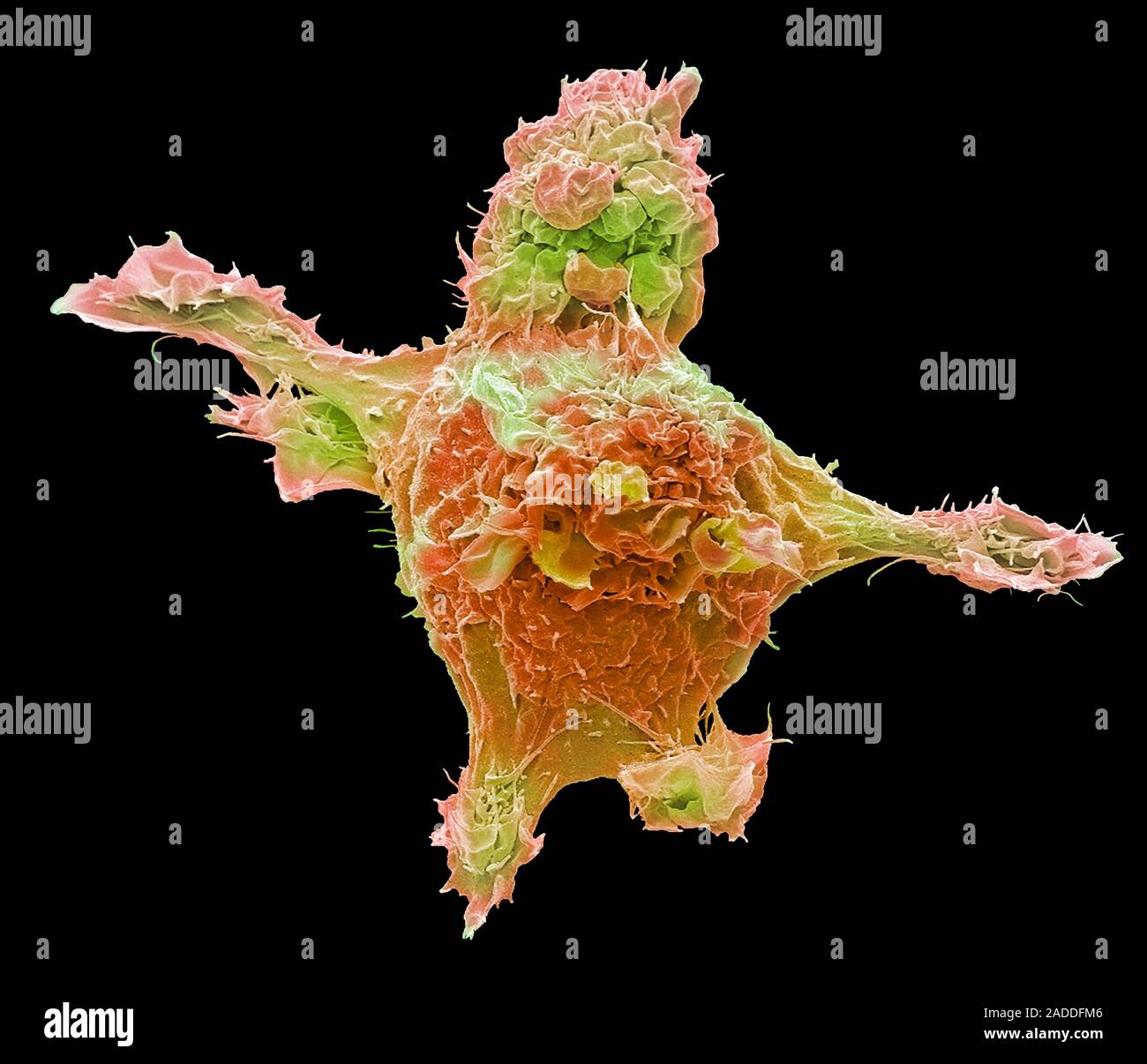 Adenovirus infected 293T cell, coloured scanning electron micrograph ...