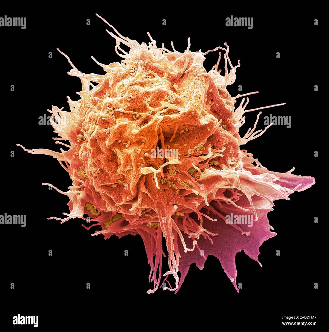 Herpes virus infected 293T cell, coloured scanning electron micrograph ...