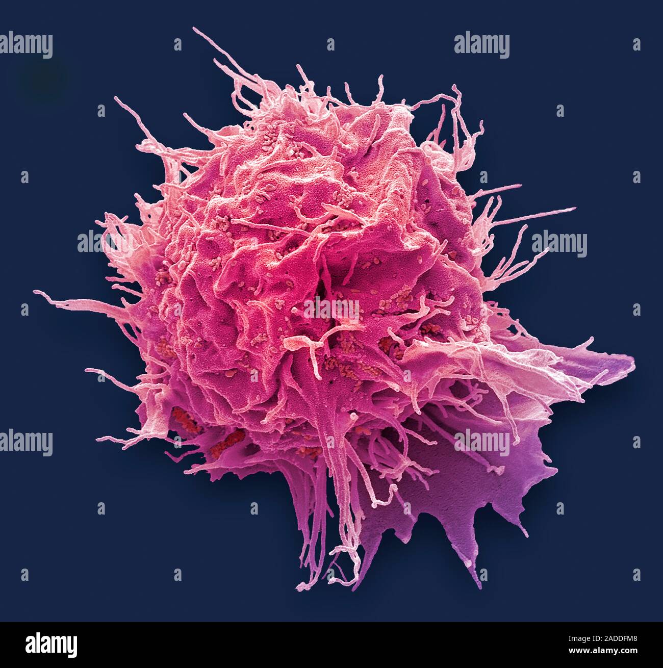 Herpes virus infected 293T cell, coloured scanning electron micrograph ...