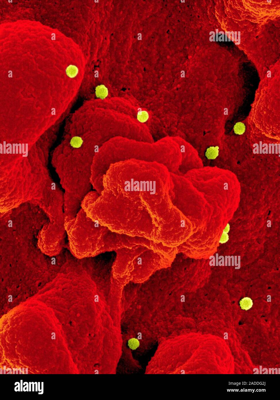 Crimean-Congo hemorrhagic fever (CCHF) virus. Coloured scanning ...