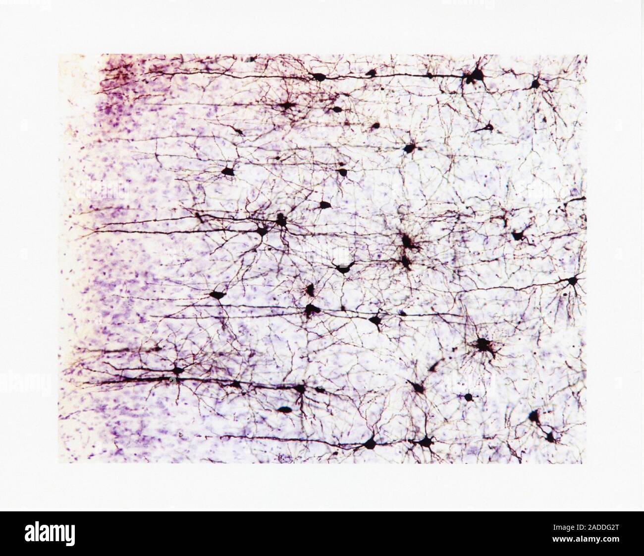 Brain cells and fibres, light micrograph. Neural staining of nerve ...