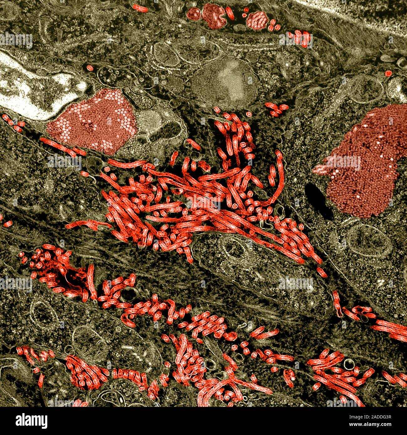 Ebola virus particles in infected tissue. Coloured transmission ...