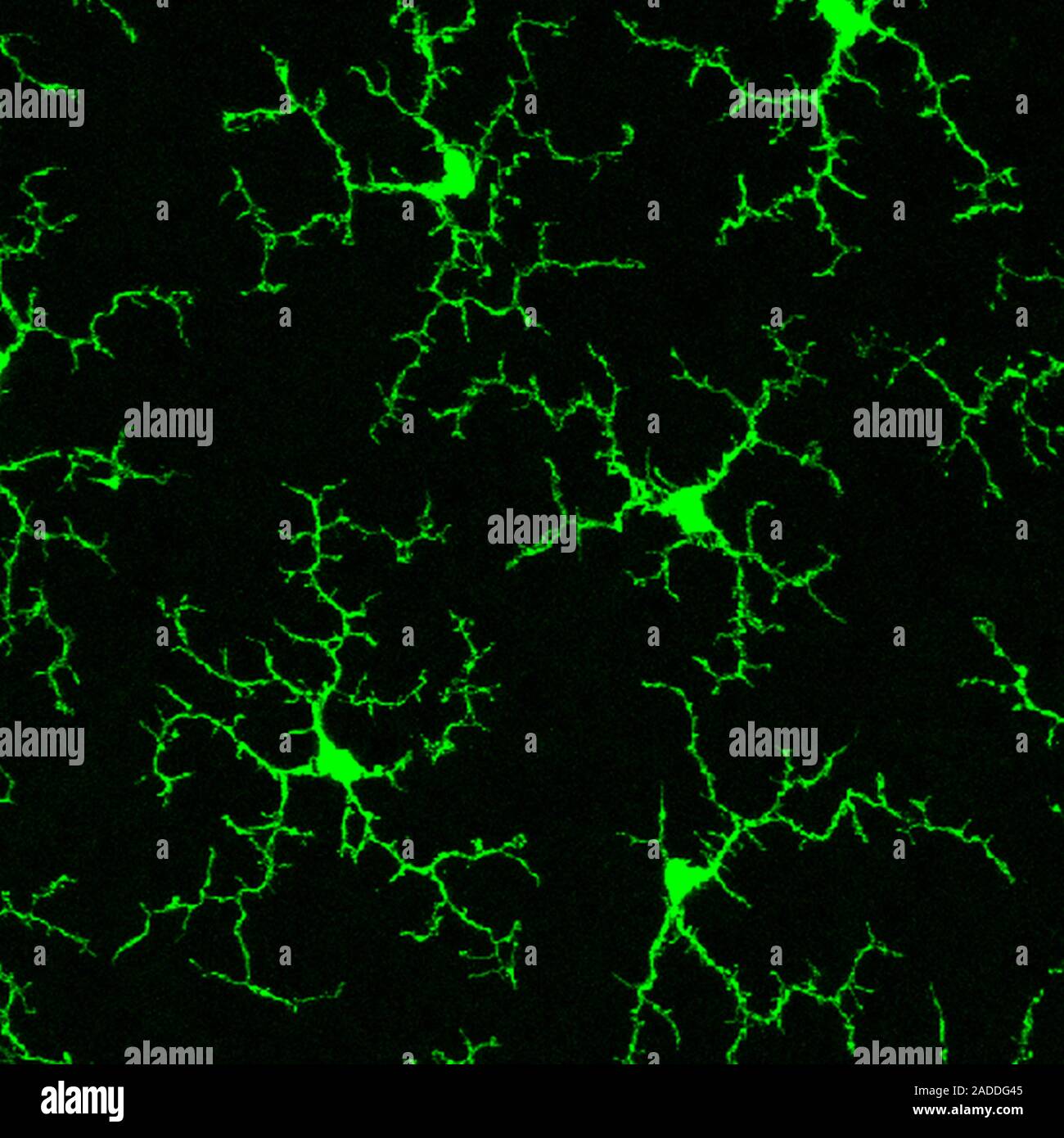 Microglia retina cells. Fluorescence light micrograph of examples of a ...