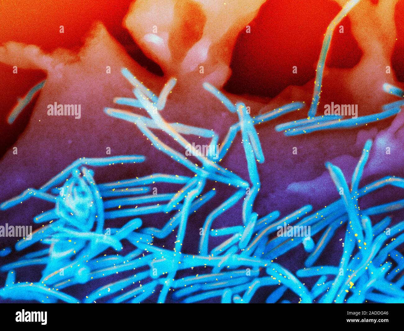 RSV virus particles in human lung cells, coloured scanning electron ...