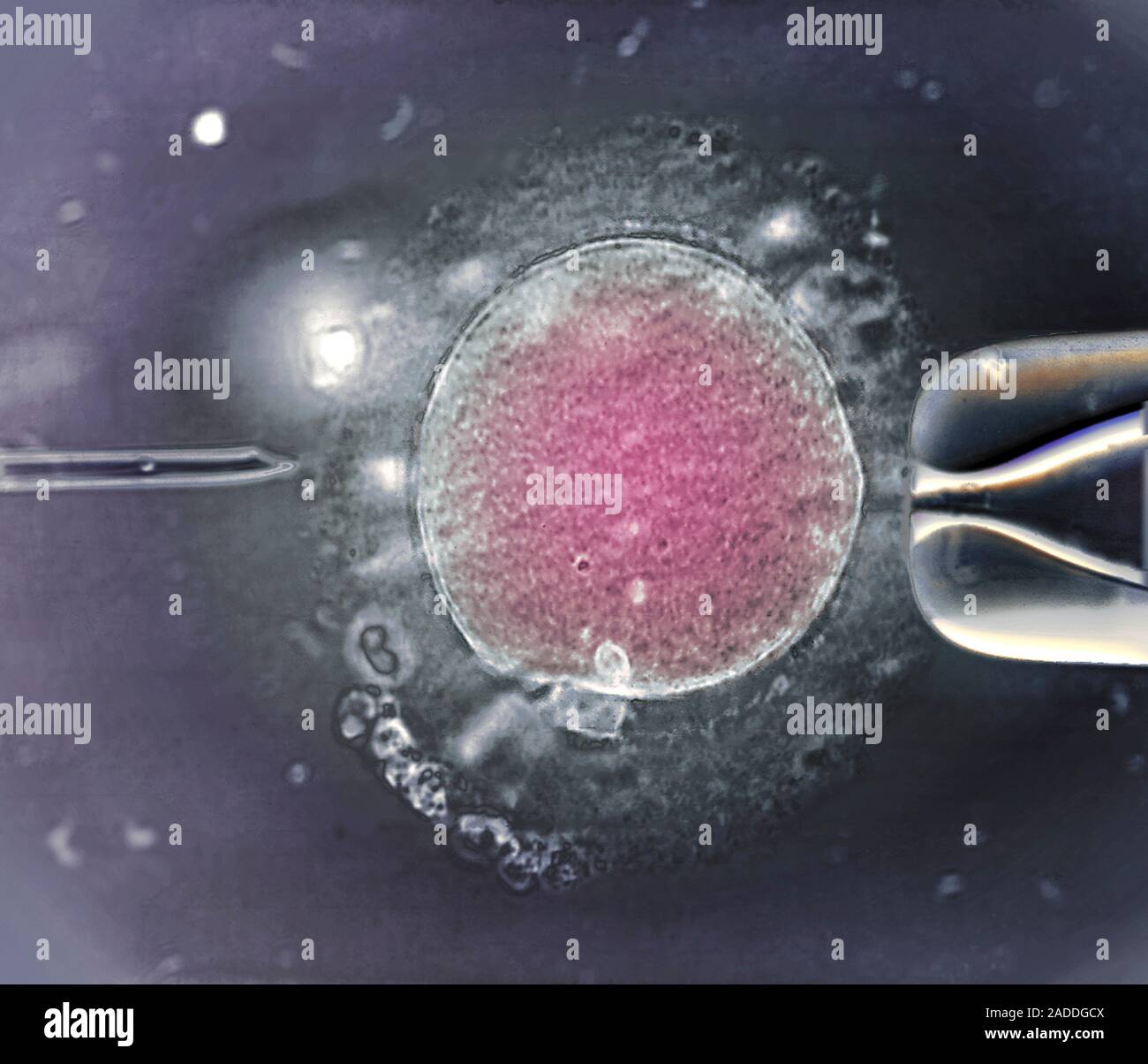 In vitro fertilisation. Light micrograph of a micro-needle (left) and ...