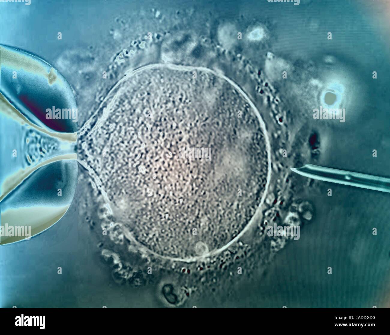 In vitro fertilisation. Light micrograph of a micro-needle (right) and ...