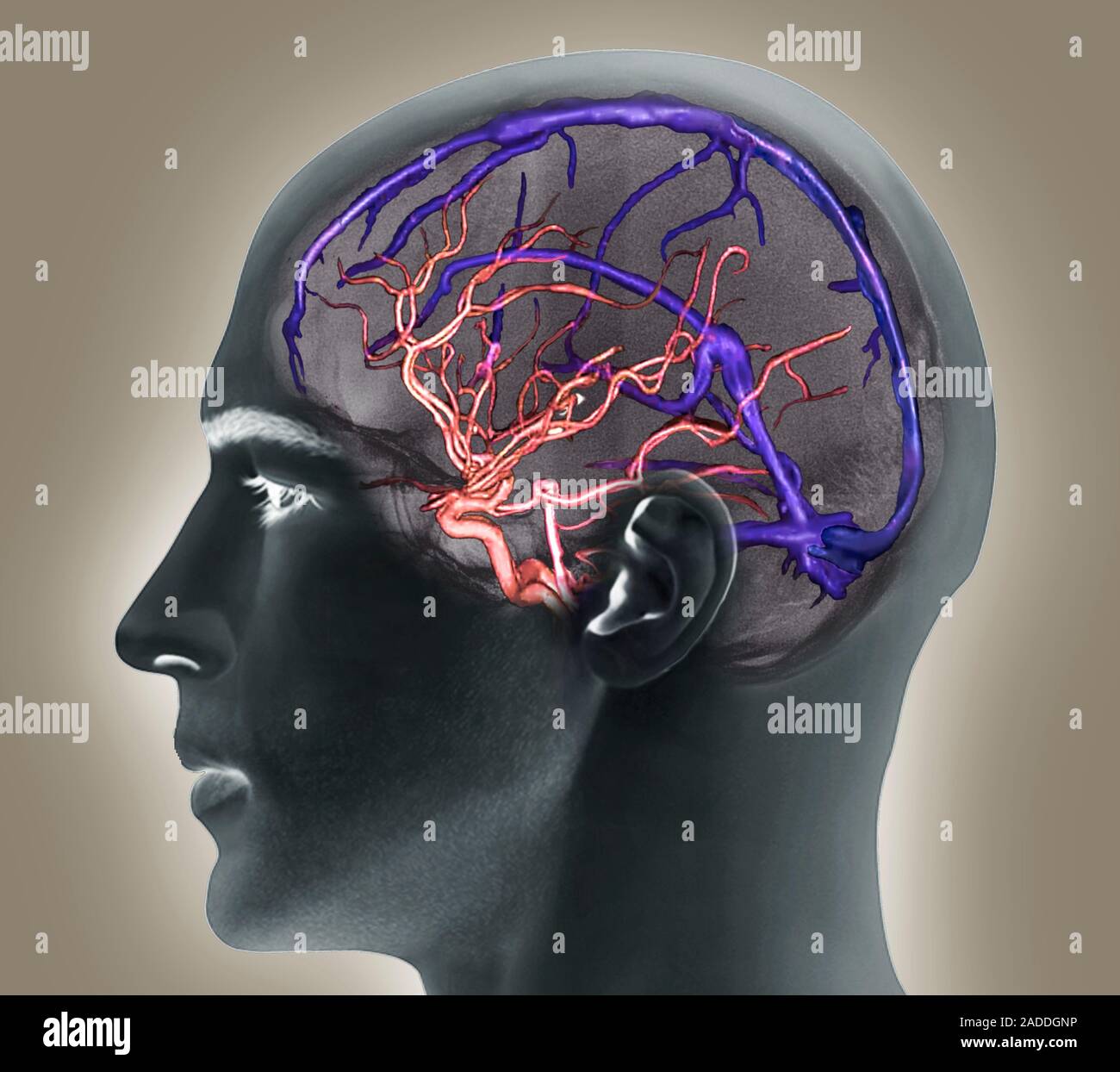 Brain arteries and venous sinuses. Coloured lateral 3D computed tomography (CT) angiogram ...