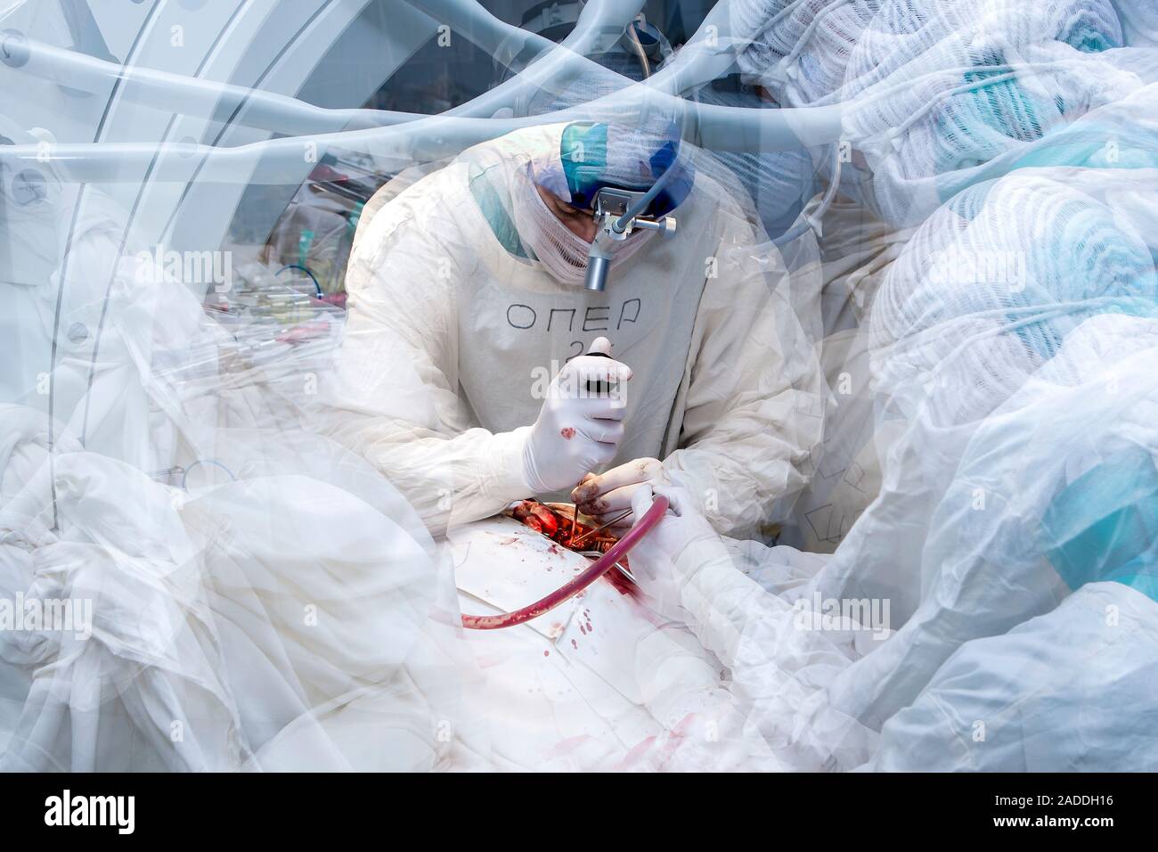 Spinal surgery, abstract image. Surgeon using a head-mounted viewing ...