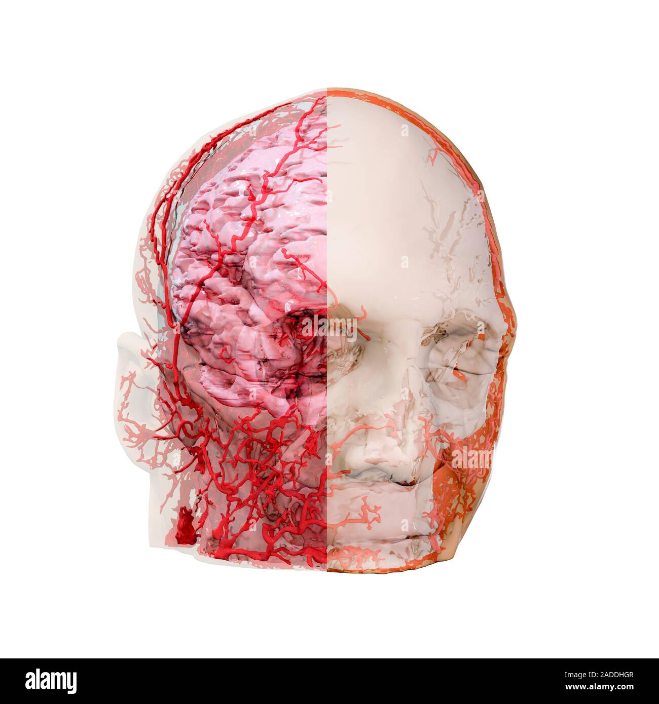 Human head and brain blood vessels. Coloured 3D computed tomography (CT ...
